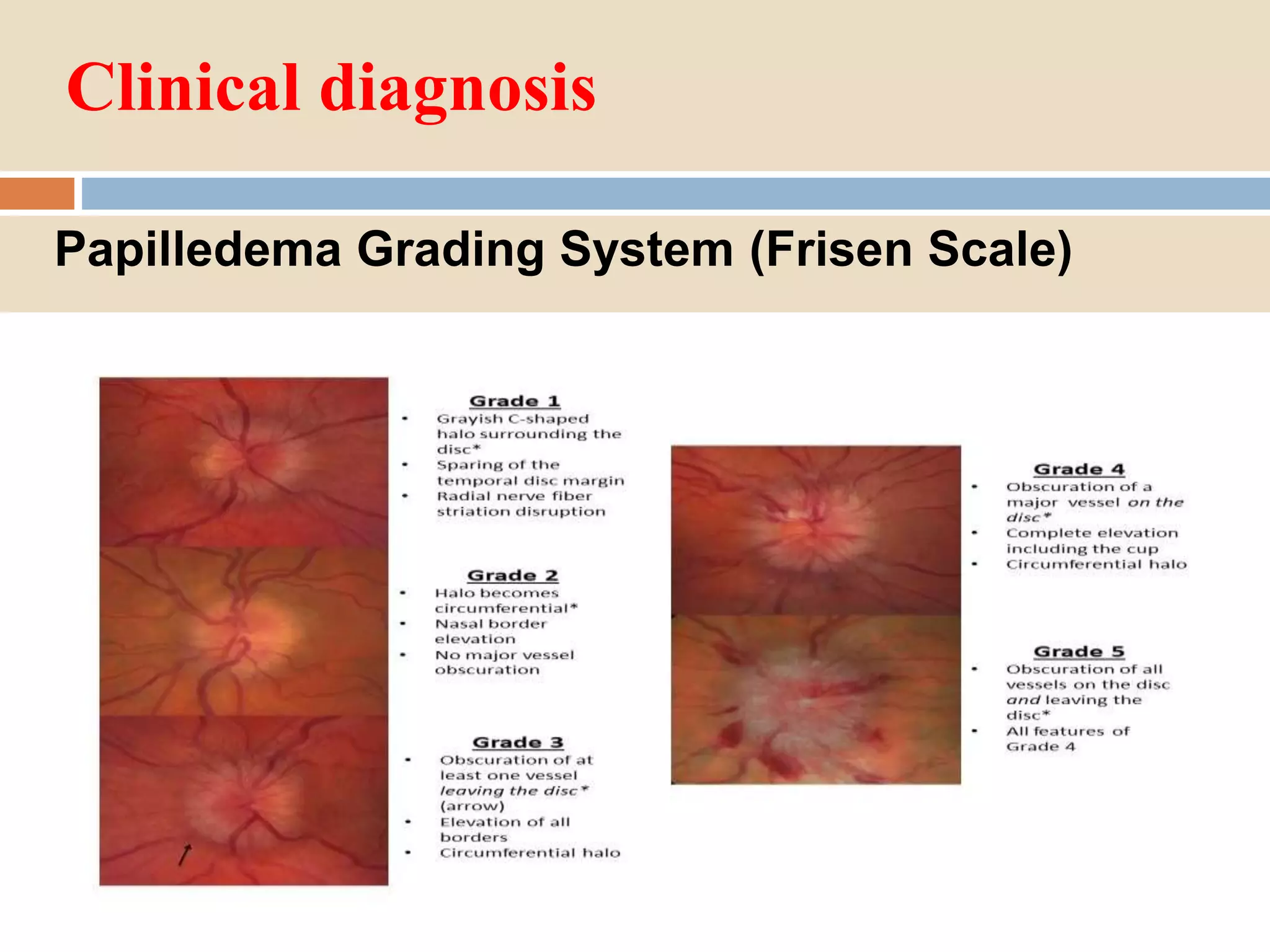 5. papilloedema | PPTX
