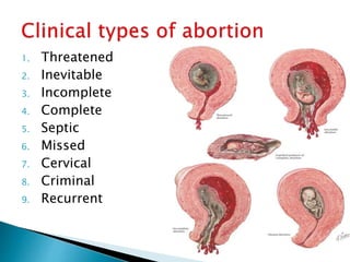 5.abnormal pregnancy.ppt