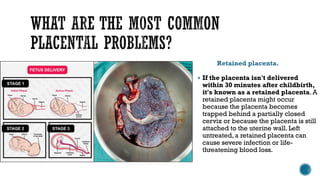 5.1 Placenta, membranes and amniotic fluid.pdf