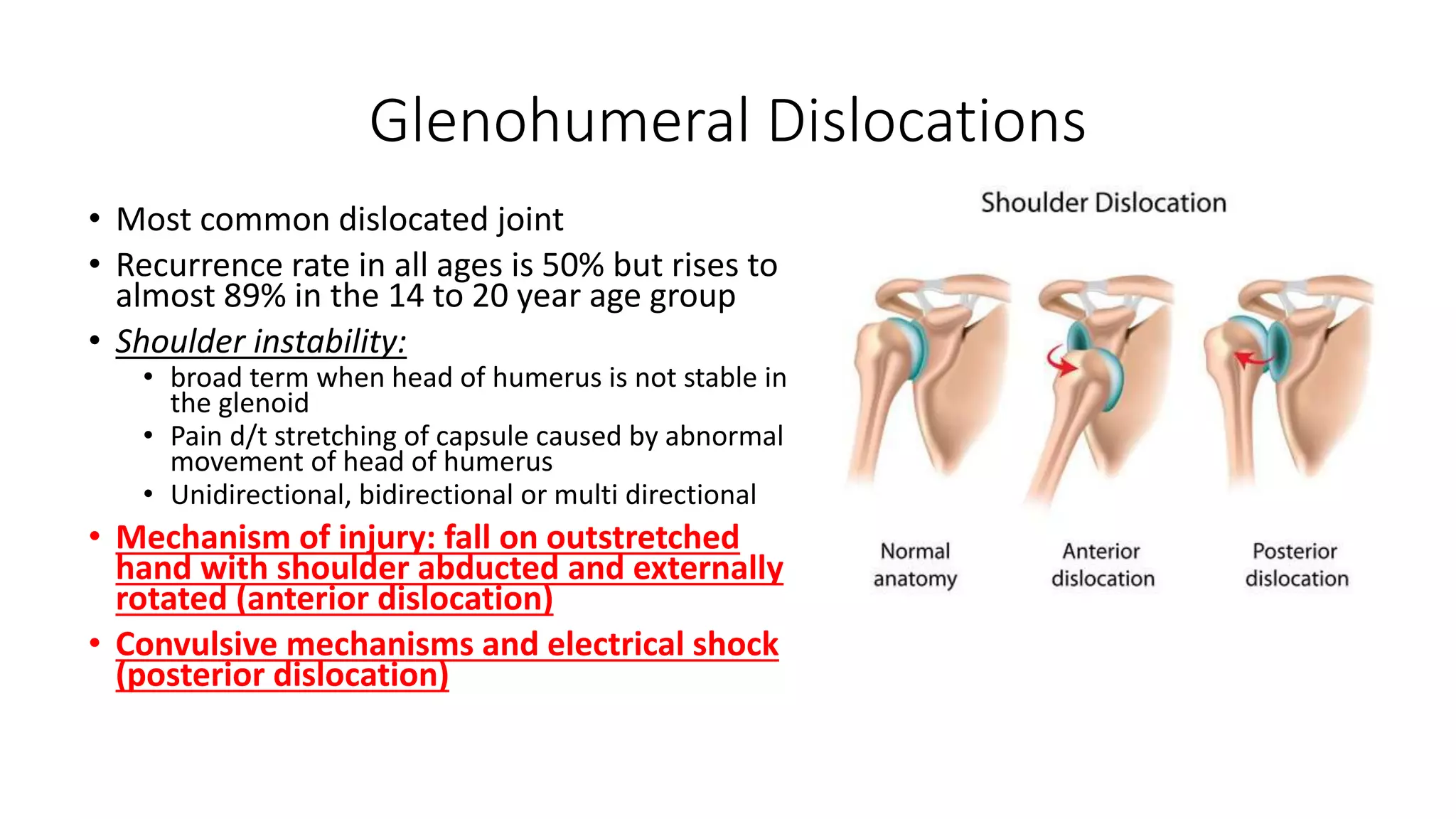 Common Dislocations and subluxations | PPTX