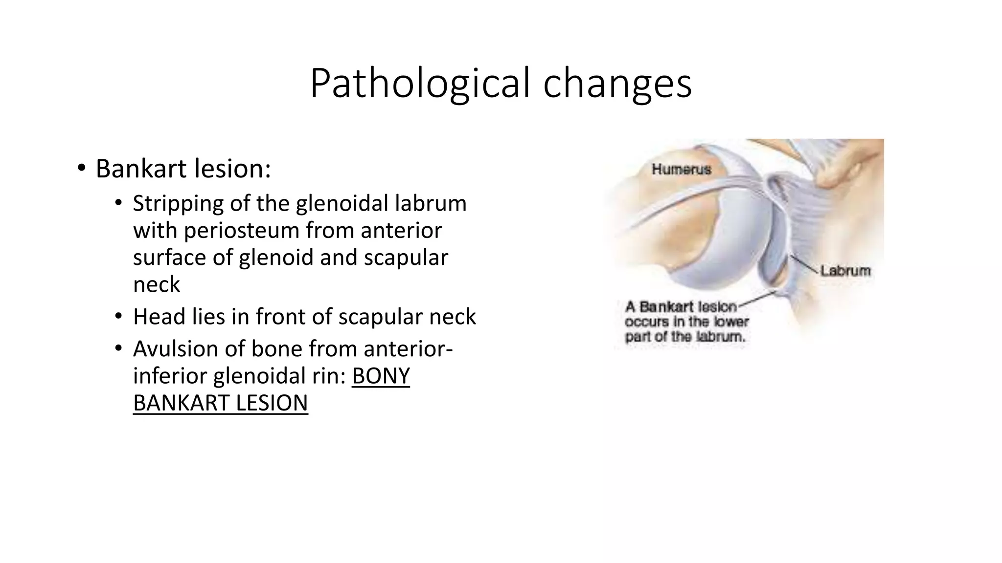 Common Dislocations and subluxations | PPTX