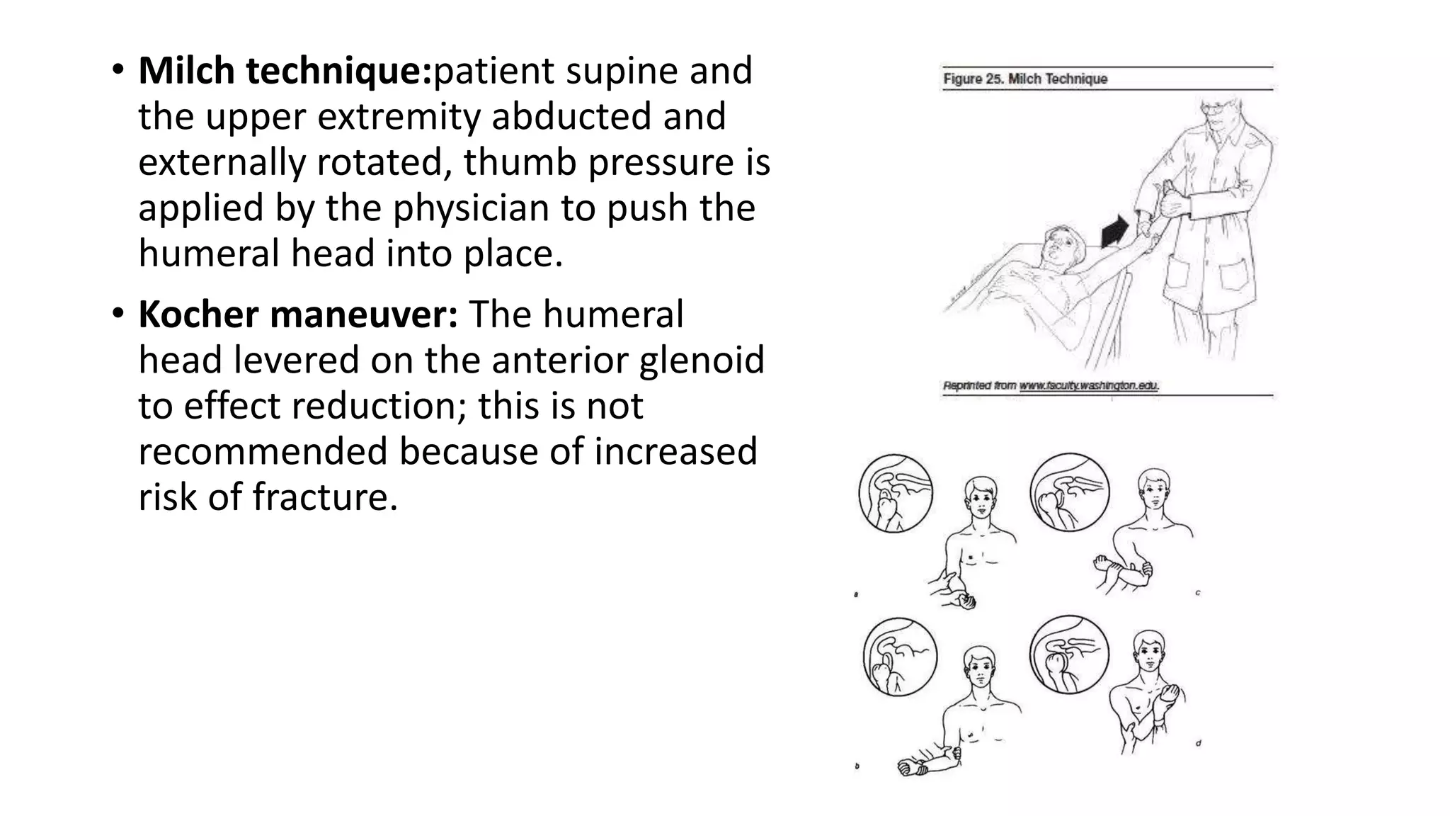 Common Dislocations and subluxations | PPTX