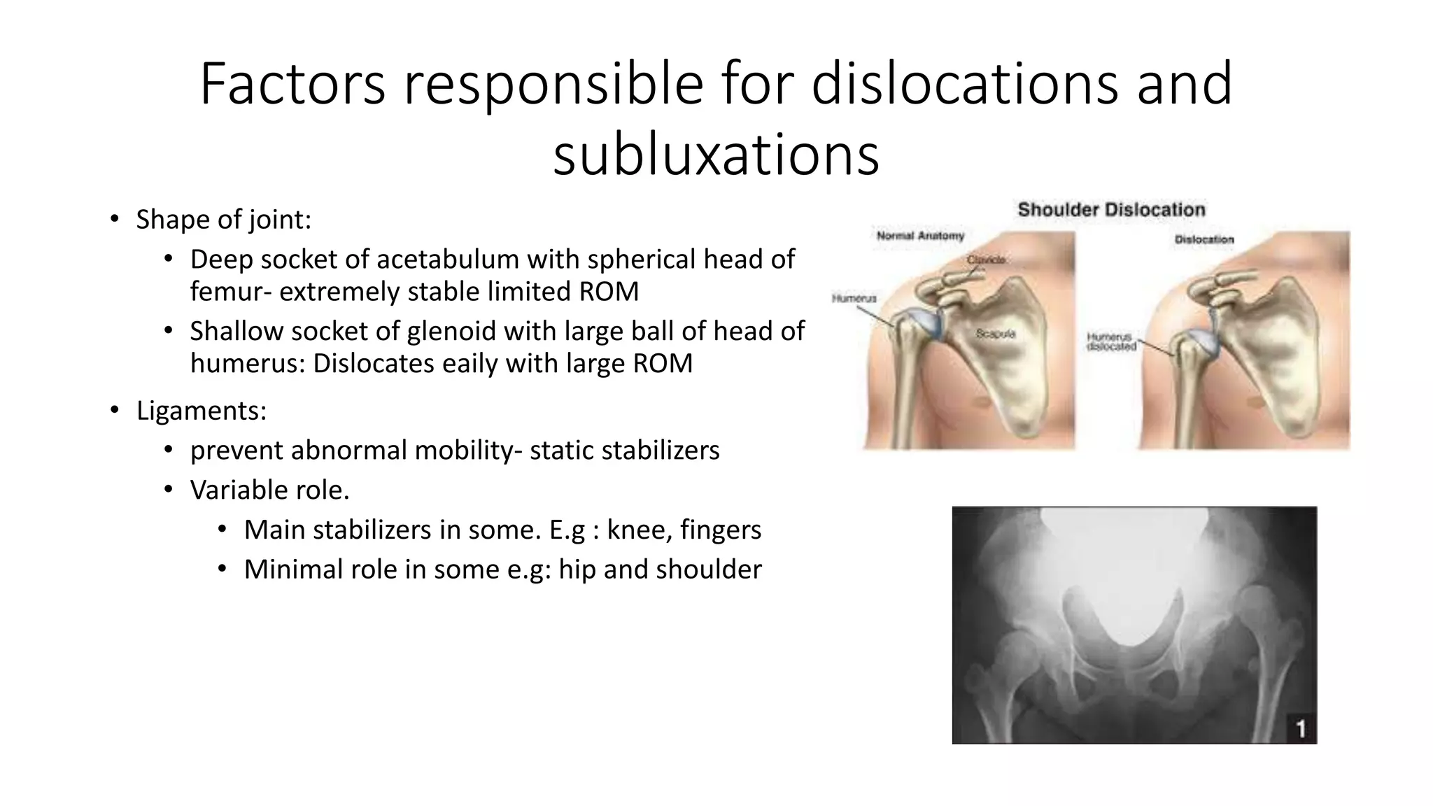 Common Dislocations and subluxations | PPTX