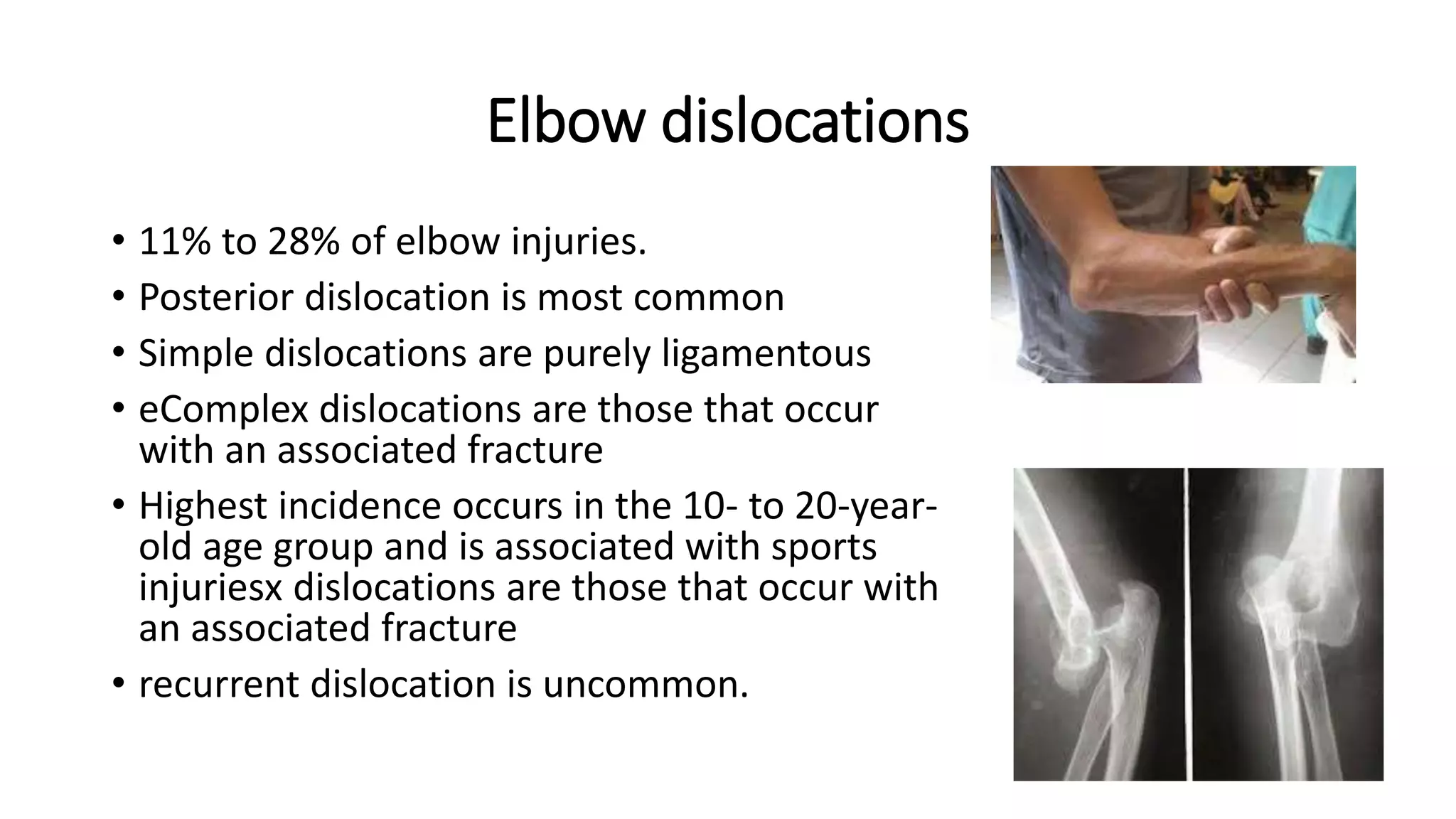 Common Dislocations and subluxations | PPTX