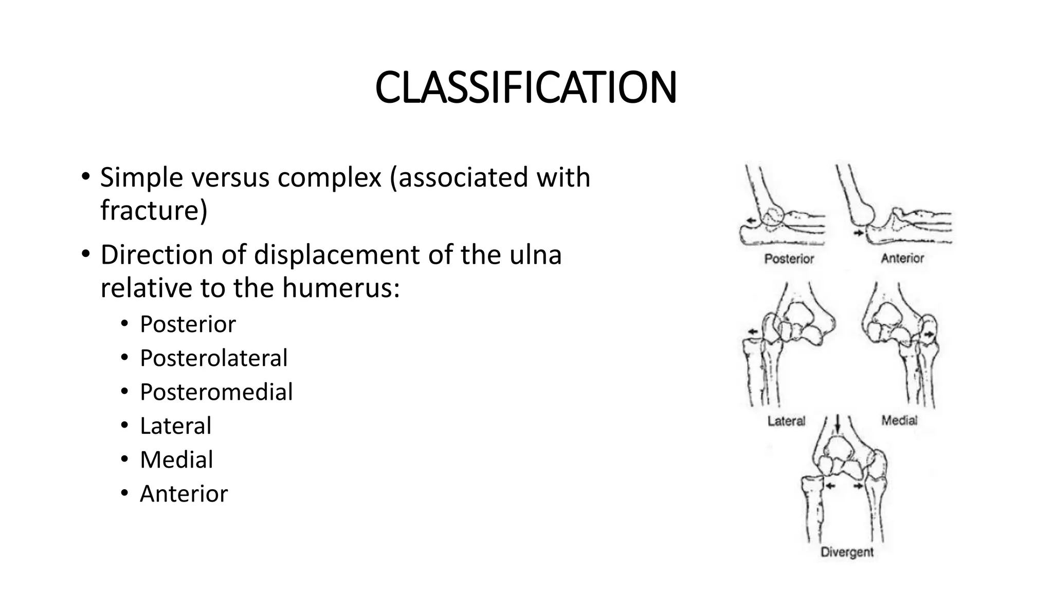 Common Dislocations and subluxations | PPTX