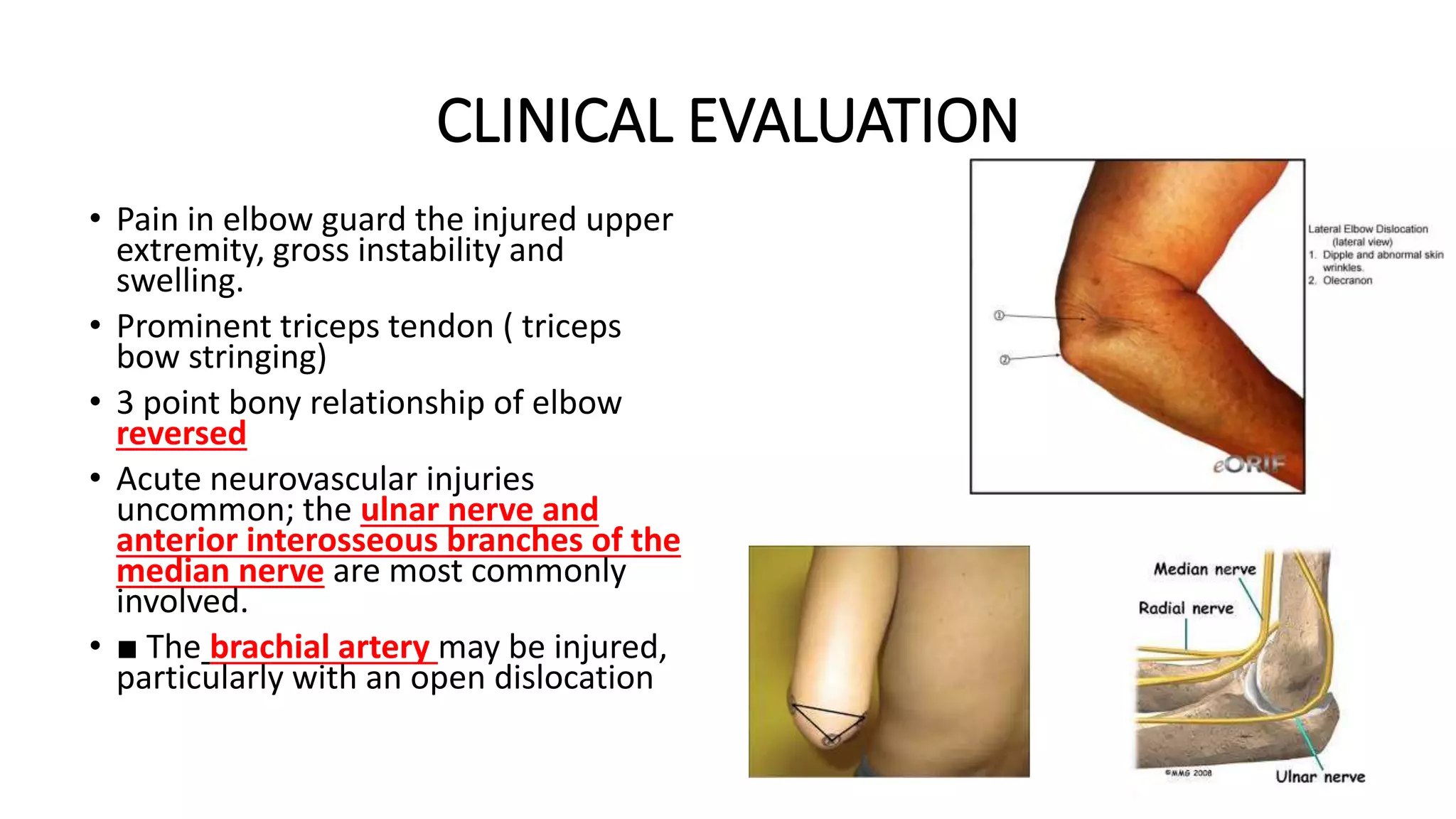 Common Dislocations and subluxations | PPTX