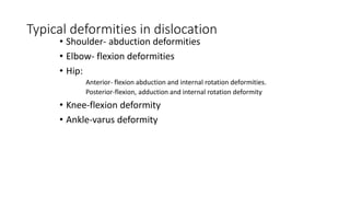 Common Dislocations and subluxations | PPTX