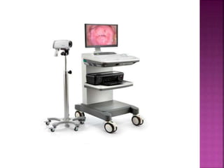 Colposcopy | PPTX