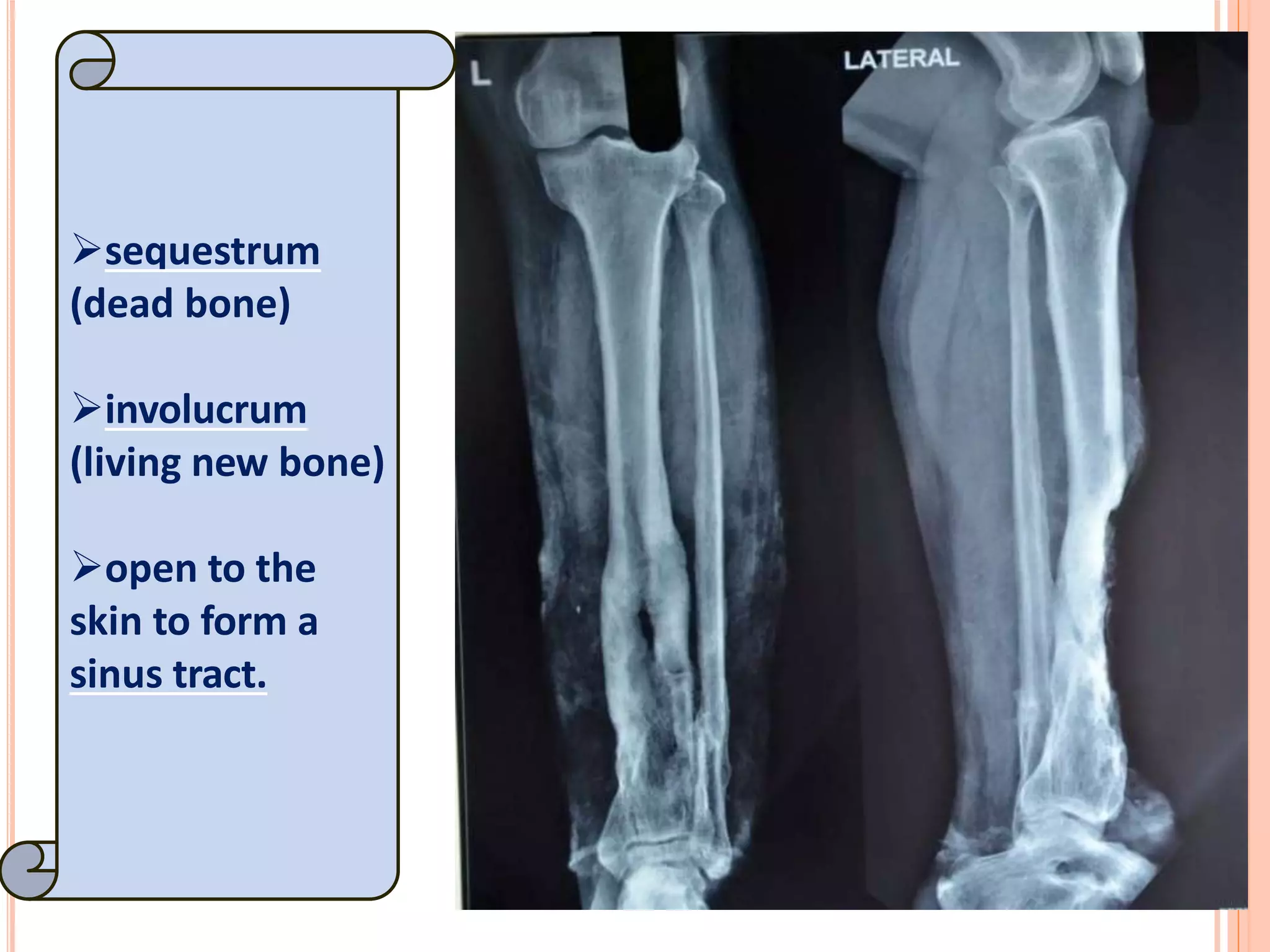 bones Radiological evaluation .pdf
