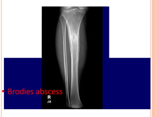 bones Radiological evaluation .pdf