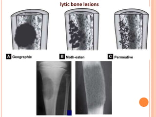 bones Radiological evaluation .pdf