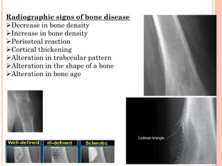 bones Radiological evaluation .pdf