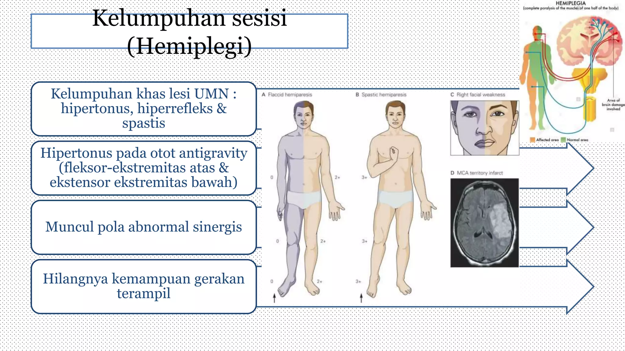 5. Cerebrovascular Accident.pptx