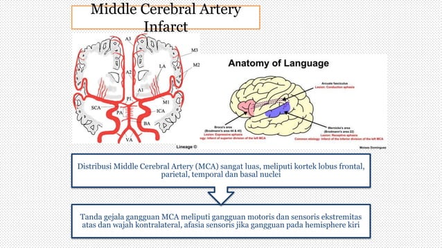 5. Cerebrovascular Accident.pptx