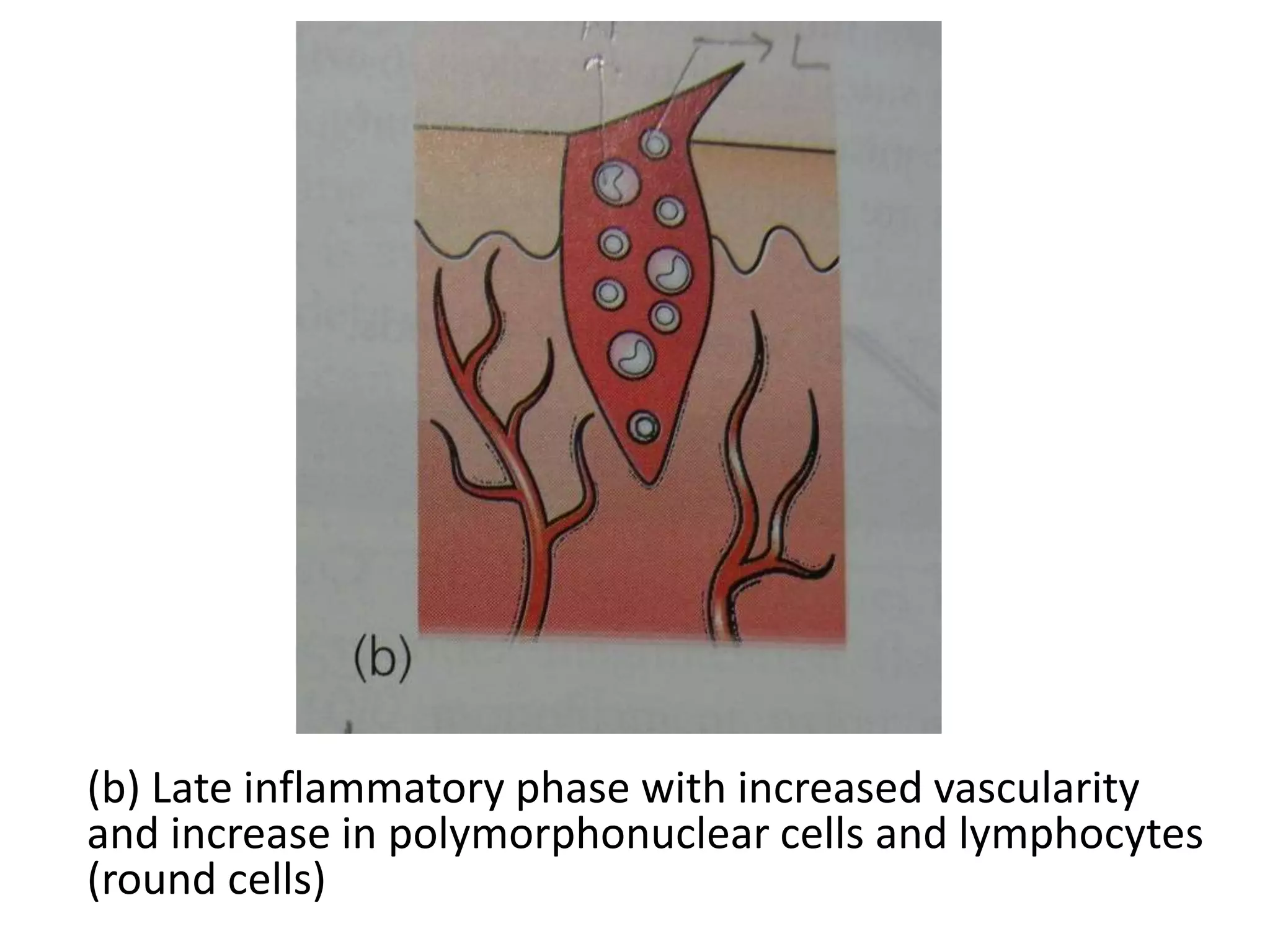5.1 Wounds, normal wound healing and factors affecting healing (2).pptx