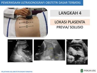 5. PENGANTAR PELATIHAN USG OBSTETRI DASAR TERBATAS VER4 - POKJA USG POGI.pptx