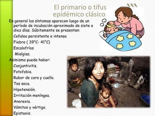 5.TIFUS.pptx