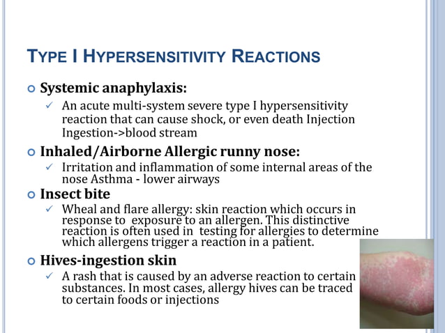 Allergic reactions.pptx | Free Download