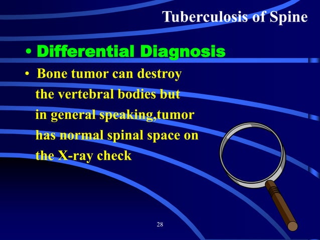 Tuberculosis of Bone and Joint.ppt | Bone and Joint Conditions ...