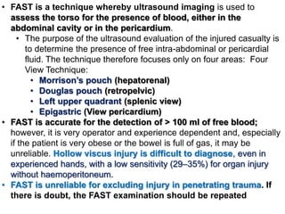 5. Abdominal Trauma Management.ppt