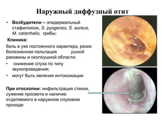 5.-Zabolevaniya-naruzhnogo-ukha_-ostryy-otit_-mastoidit.ppt