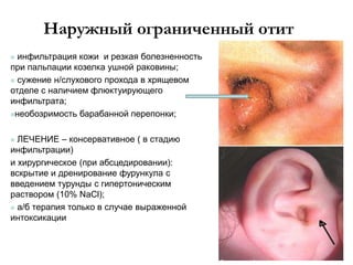 5.-Zabolevaniya-naruzhnogo-ukha_-ostryy-otit_-mastoidit.ppt