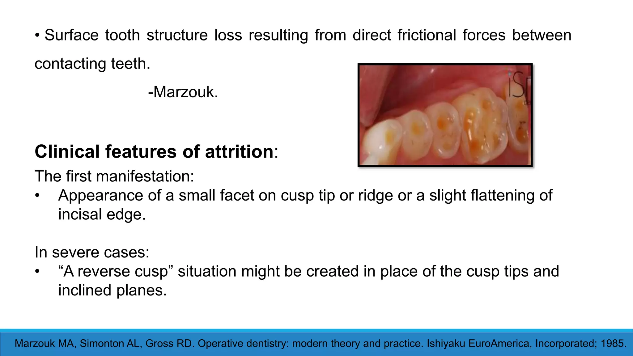 NON CARIOUS DESTRUCTION AND DISFIGUREMENT OF TEETH (20.9.21).pptx