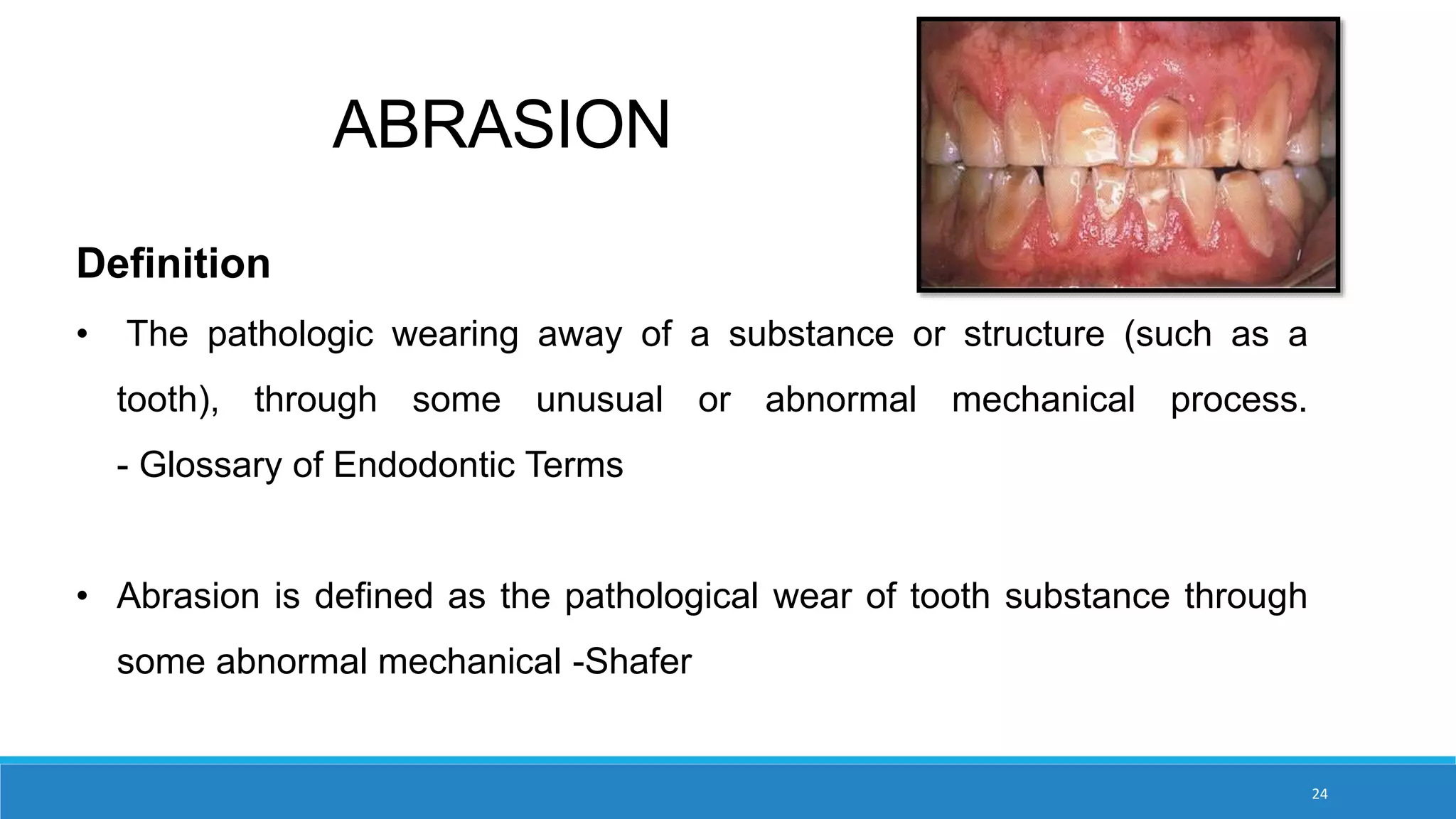 NON CARIOUS DESTRUCTION AND DISFIGUREMENT OF TEETH (20.9.21).pptx