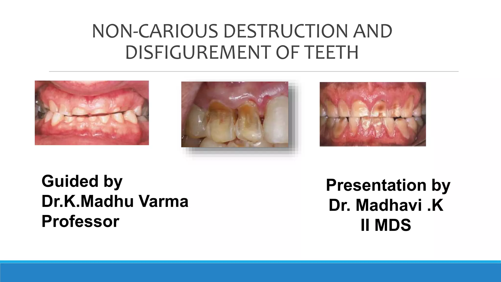 NON CARIOUS DESTRUCTION AND DISFIGUREMENT OF TEETH (20.9.21).pptx