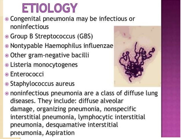 5.Congenital pneumonia.pptx