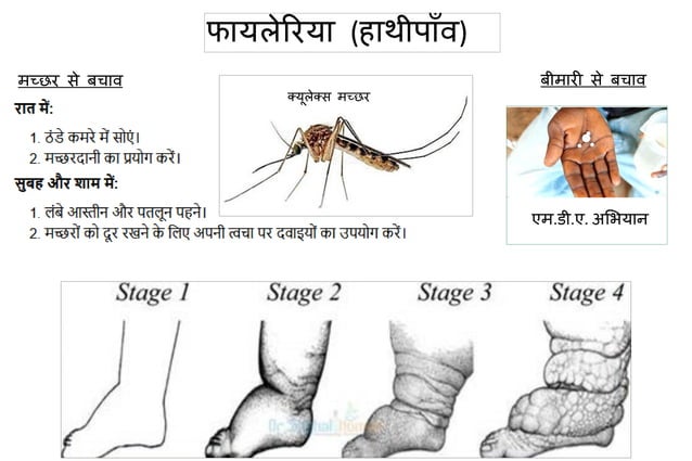 Filaria wall poster Hindi | PDF