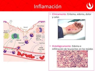 5. PPT marcadores de inflamacion(2).pdf