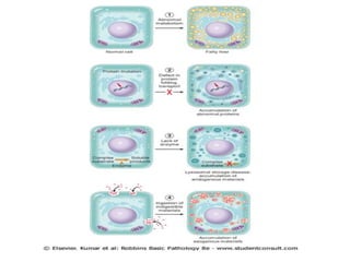 5. intracellular accumulation.pptx