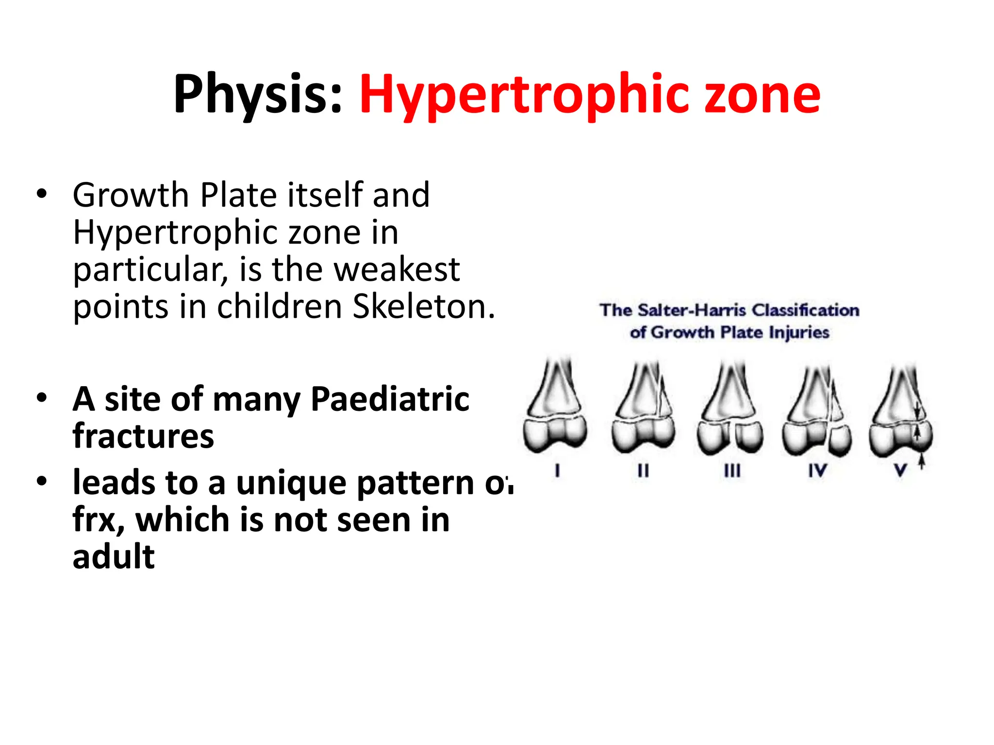 Principles, pitfalls & problems of Paediatrics Fractures AKU 2023.pptx | Death, Injury, or ...