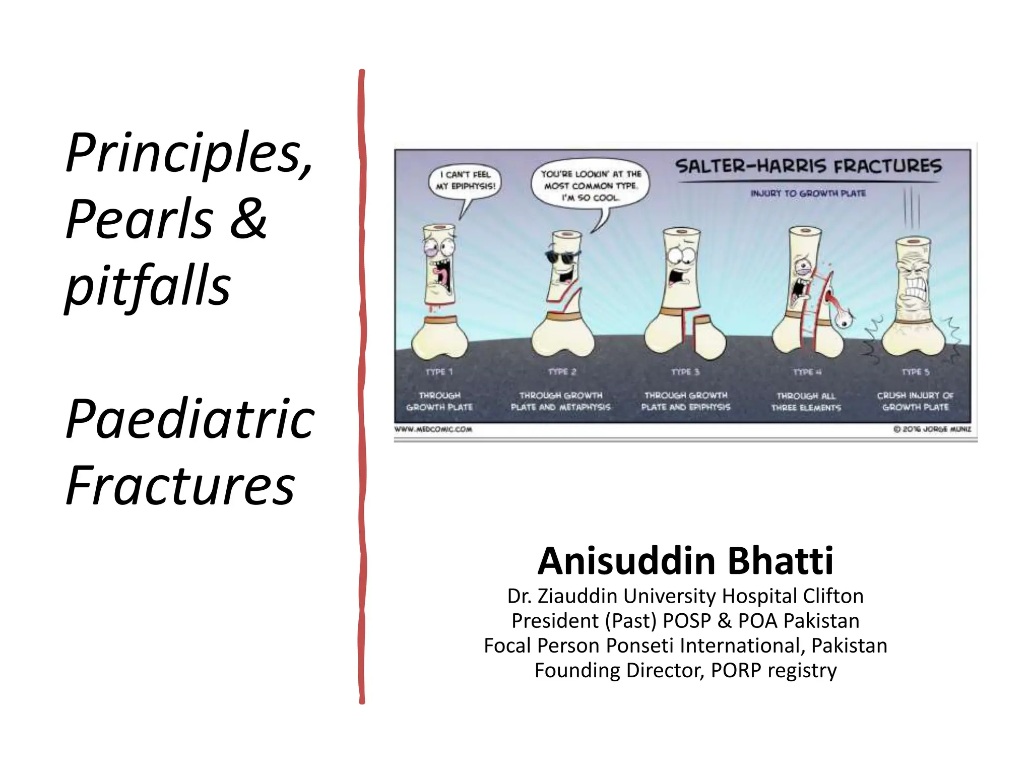 Principles, pitfalls & problems of Paediatrics Fractures AKU 2023.pptx | Death, Injury, or ...