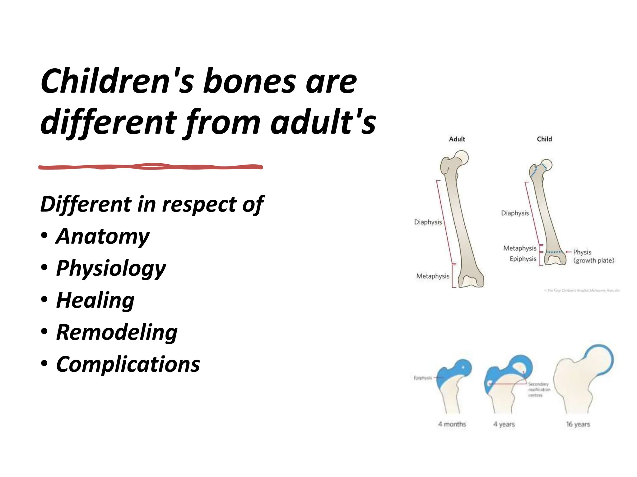 Principles, pitfalls & problems of Paediatrics Fractures AKU 2023.pptx ...