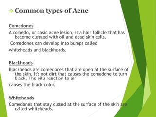 5. Acne Pharmacology | PDF