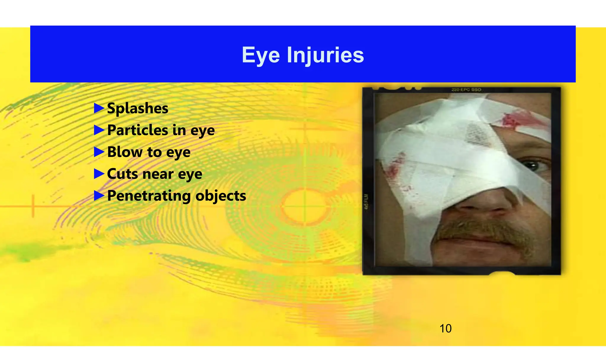 First Aid for management of Specific Injuries.pptx