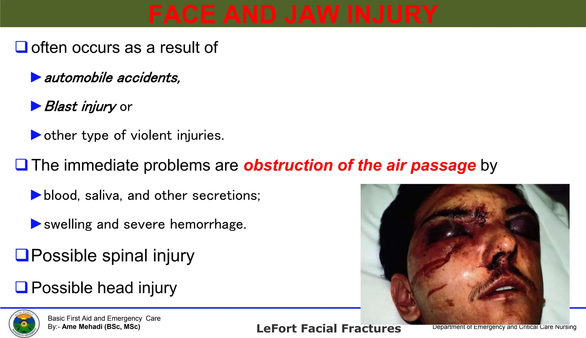 First Aid for management of Specific Injuries.pptx