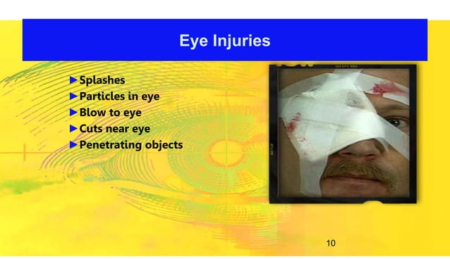 First Aid for management of Specific Injuries.pptx
