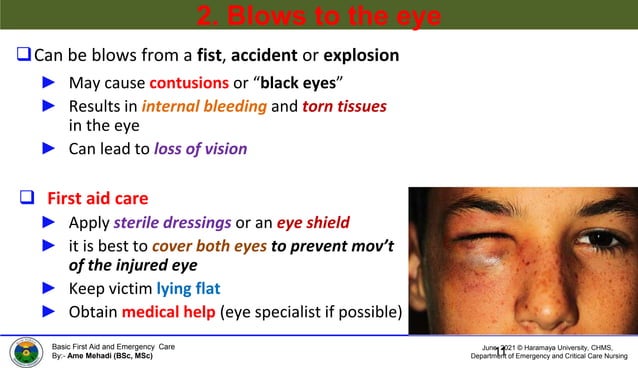 First Aid for management of Specific Injuries.pptx
