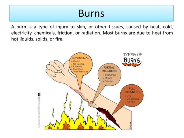 5. Burns. Frostbite. Electrical injury-1.pptx