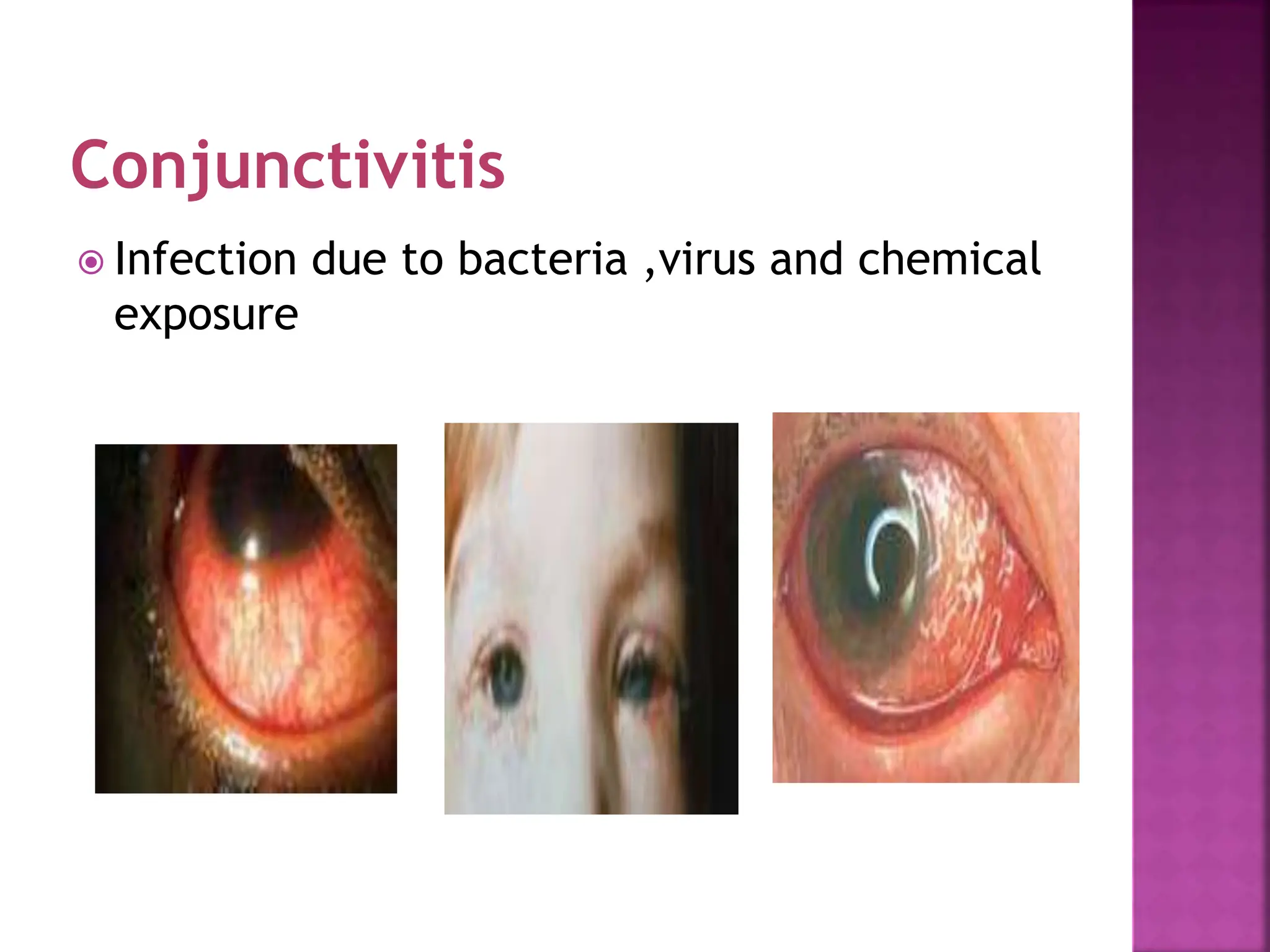 5. Eye Assessment.ppt Nursing Student Content | PPT