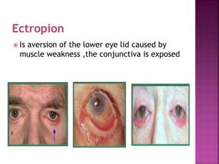5. Eye Assessment.ppt Nursing Student Content | PPT