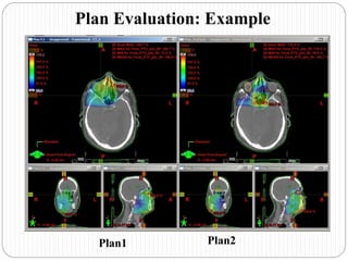 5.Plan Evaluation, DVH Analysis, TPS.pptx