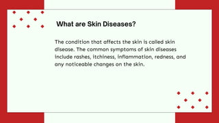 Know about the most common dermatologic disease. | PPT