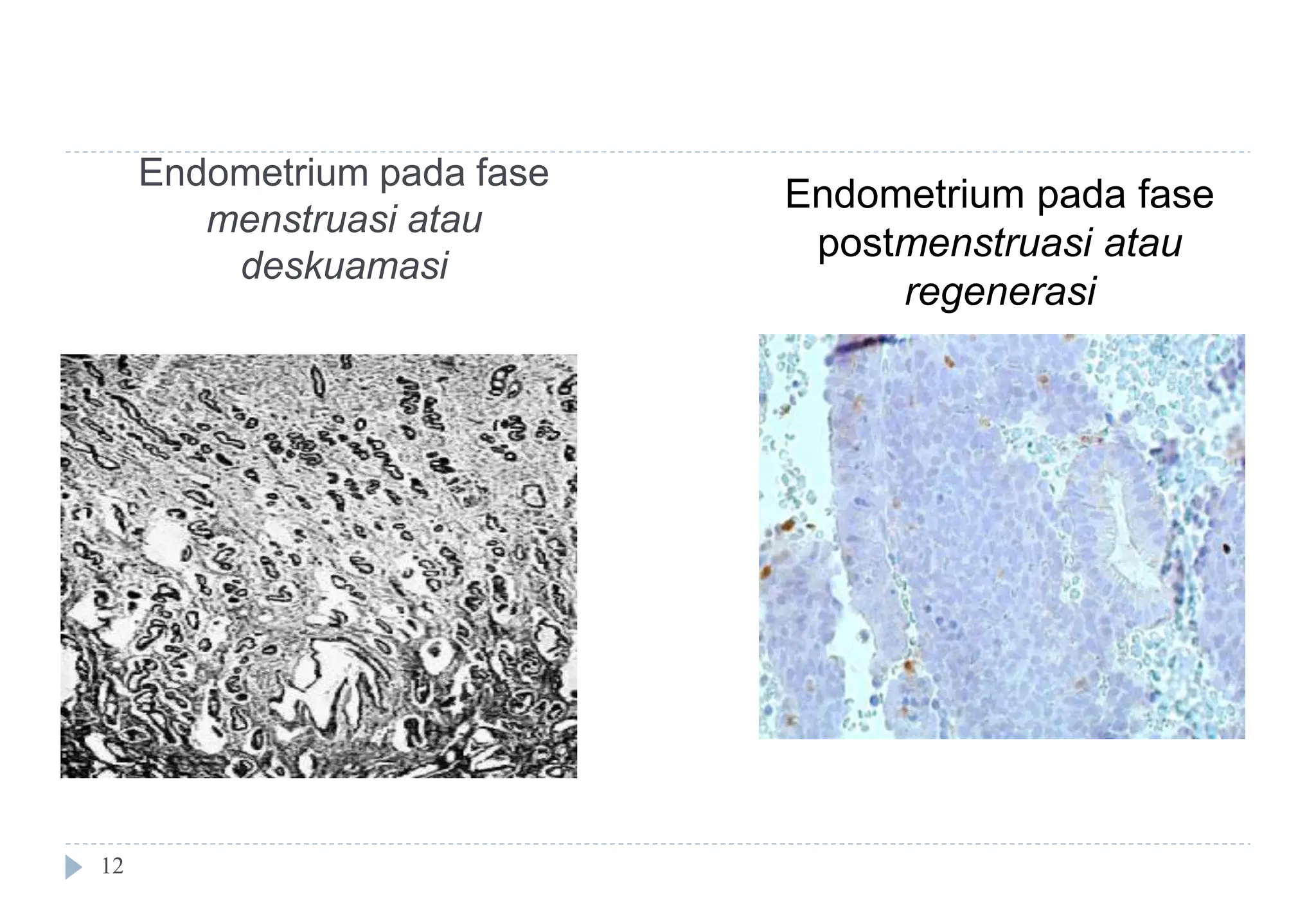 fisiologi menstruasi menstruasi pada wanita | PPT