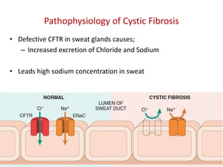 Cystic Fibrosis and its Pathophysiology | PPTX