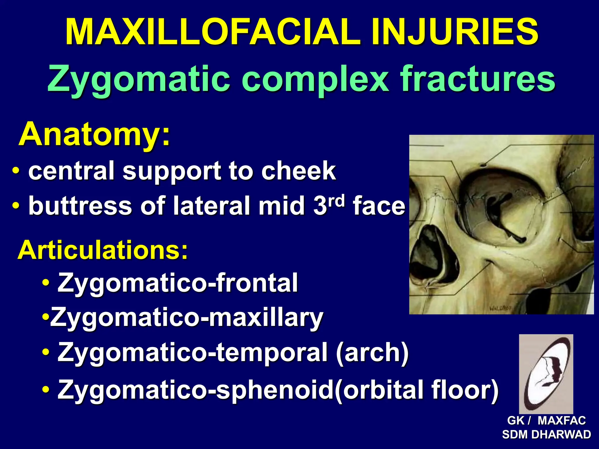 zygoma fracture inju & complications.ppt
