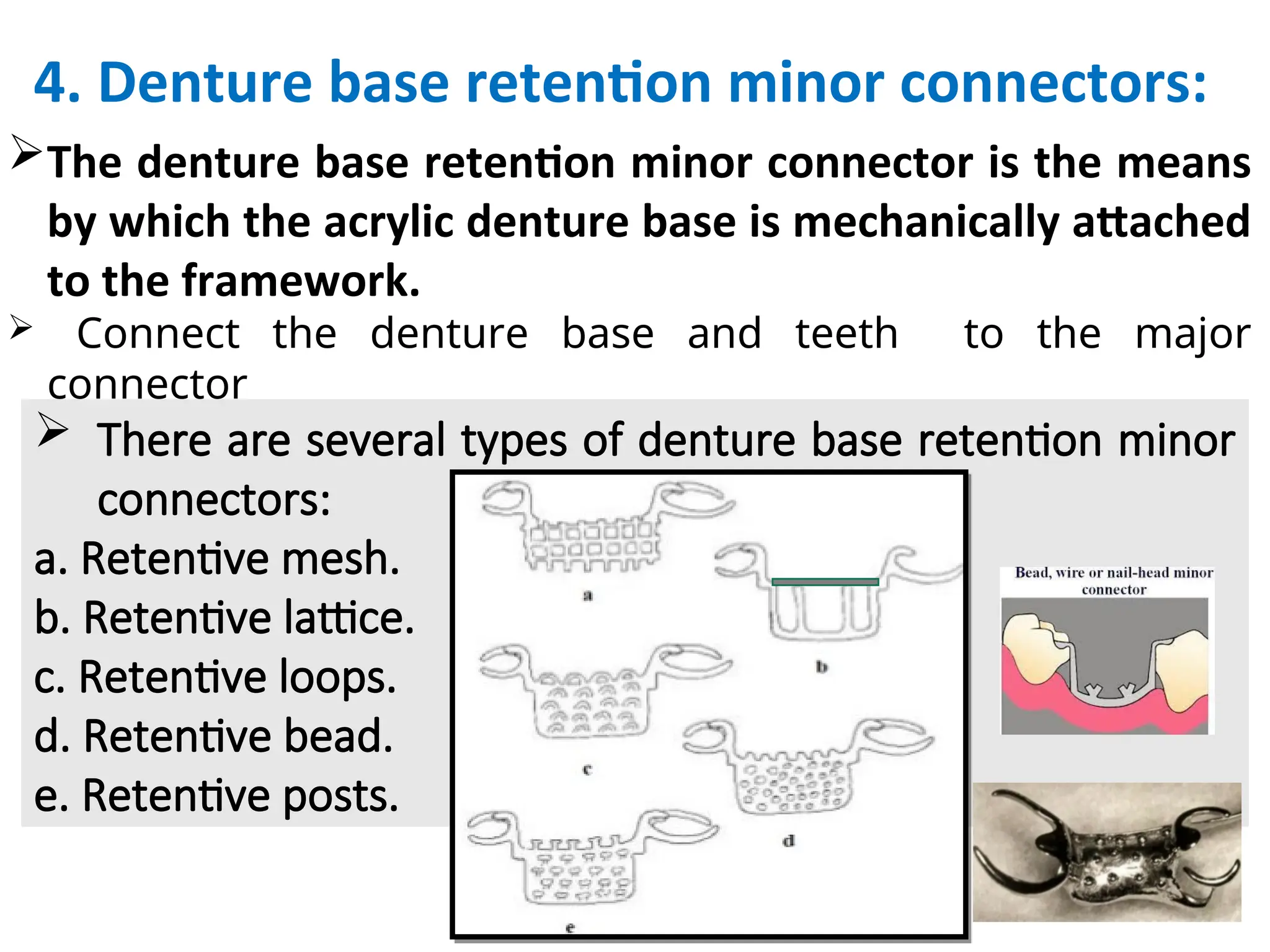 5. Minor connectors Removable partial denture.ppt